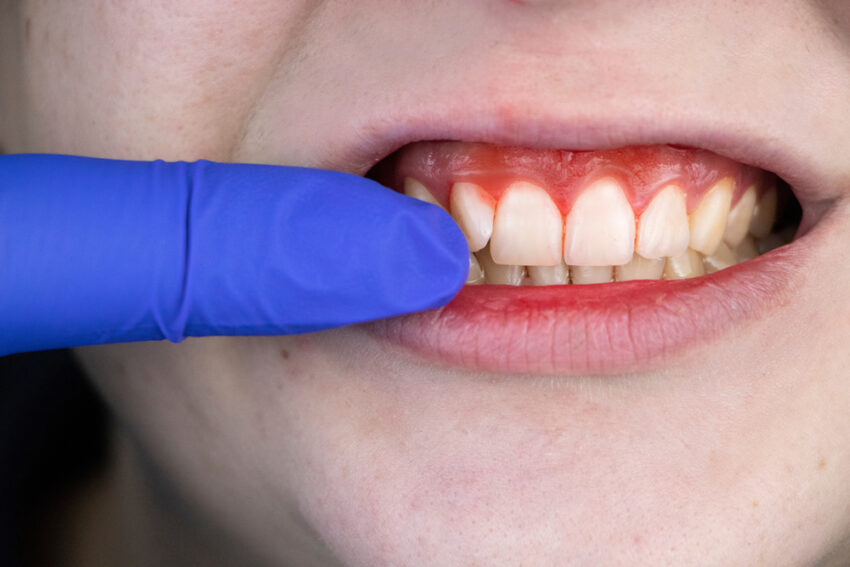 Přírodní látky, které slouží jako prevence a domácí léčba nepříjemné ...